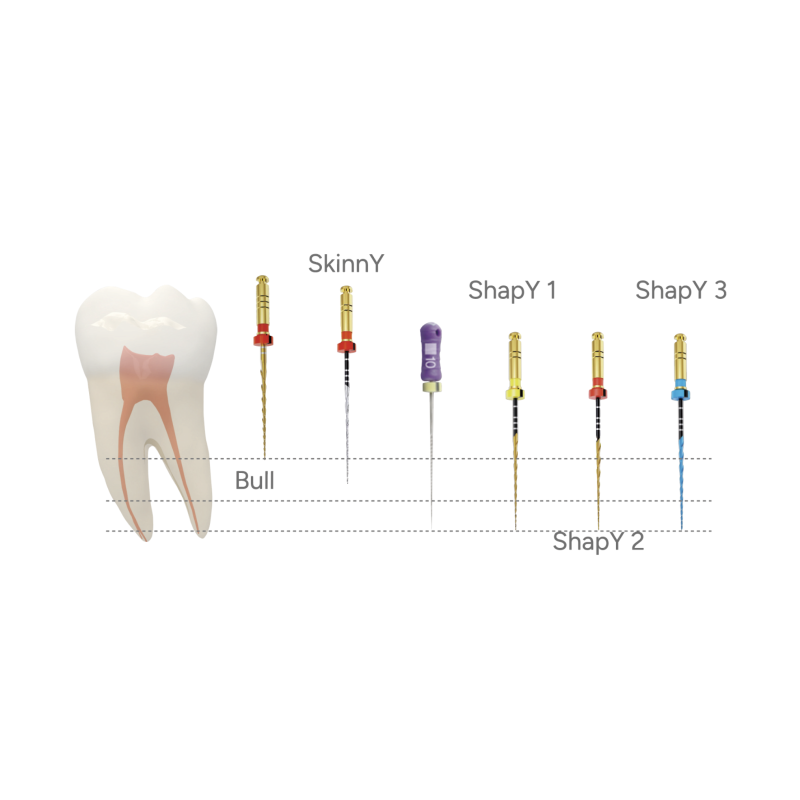 Limes de retraitement endodontique